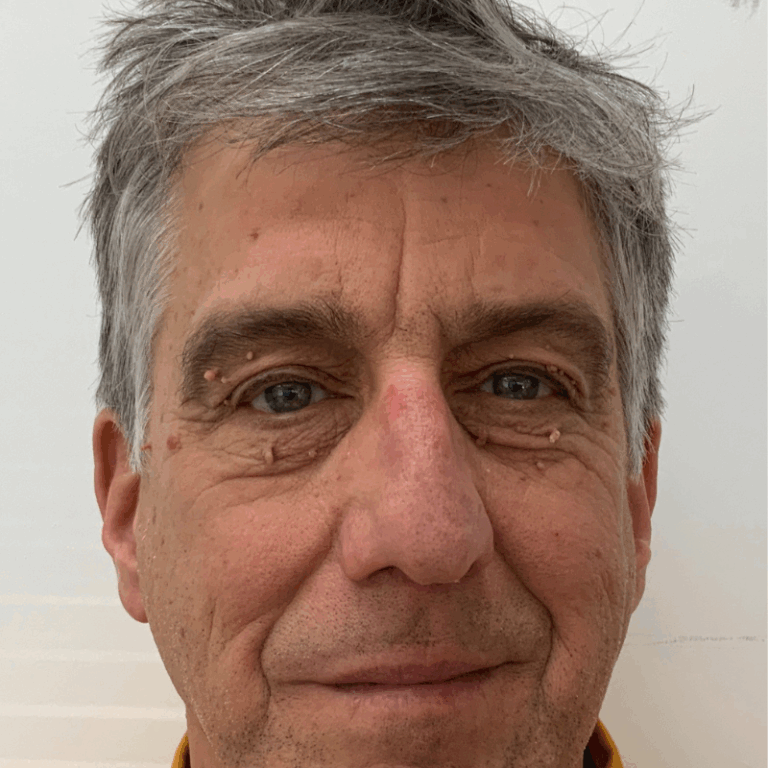 Firming Facial Skin – Medispa Physimed